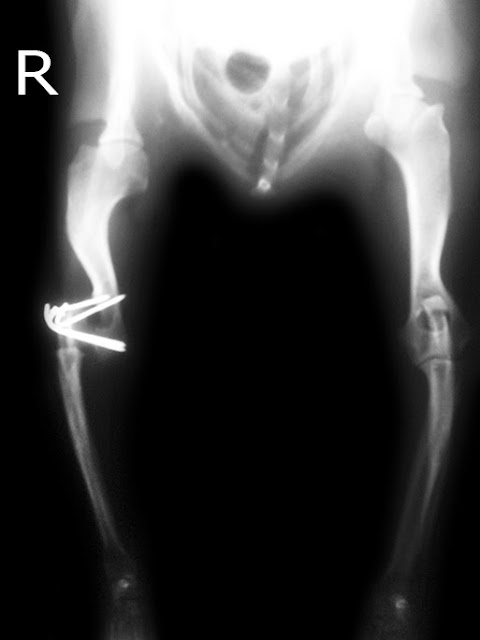 ARTROVET: Fractura y luxación de codo