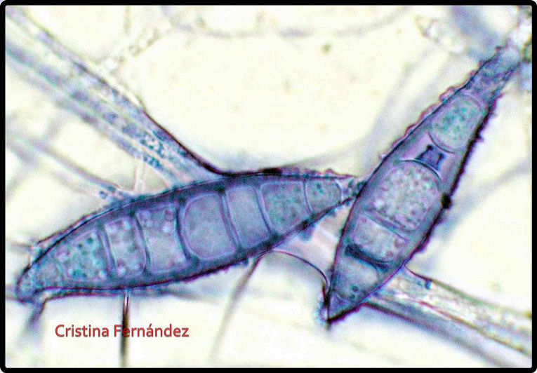 laboratorio 6G: investigacion, "micosis superficiales"