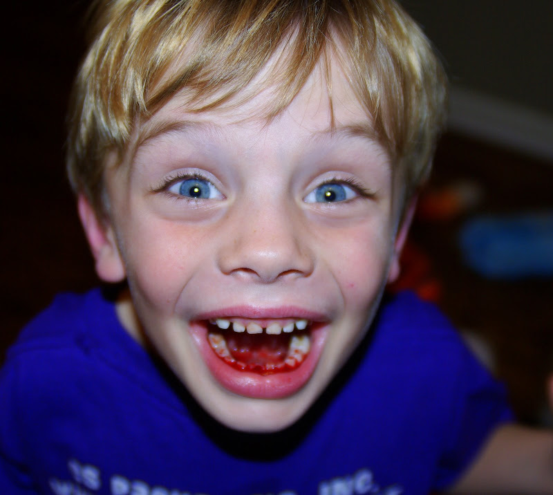 mini and brothers: 1st Tooth!