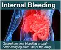 Internal Bleeding, Eye Wounds and Embedded Objects ~ How to do First Aid