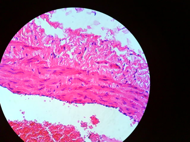 Ca - CaDo (Catatan Calon Dokter): Histologi Sistem Cardiovascular