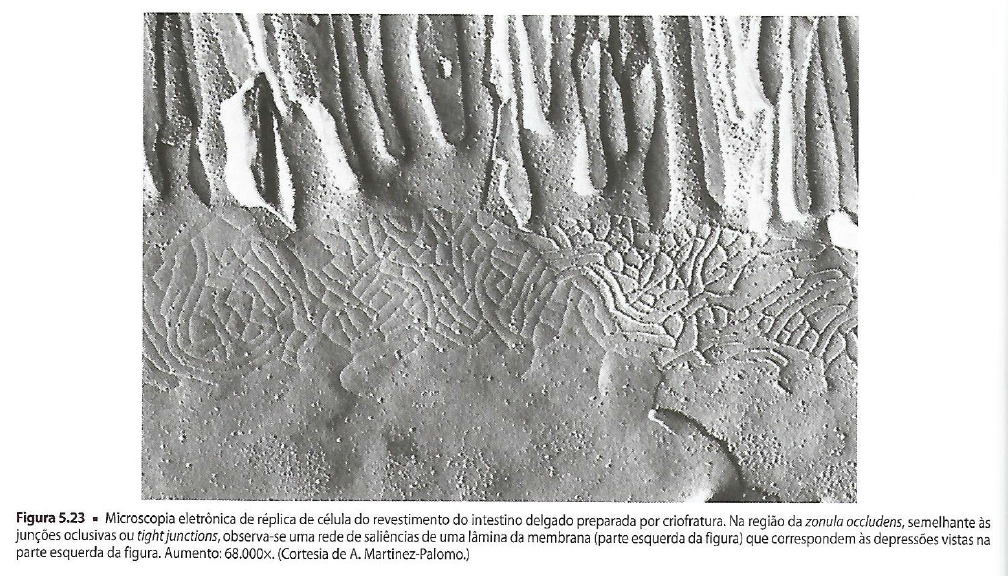 Microscopia eletônica de réplica de célula do revestimento do intestino ...