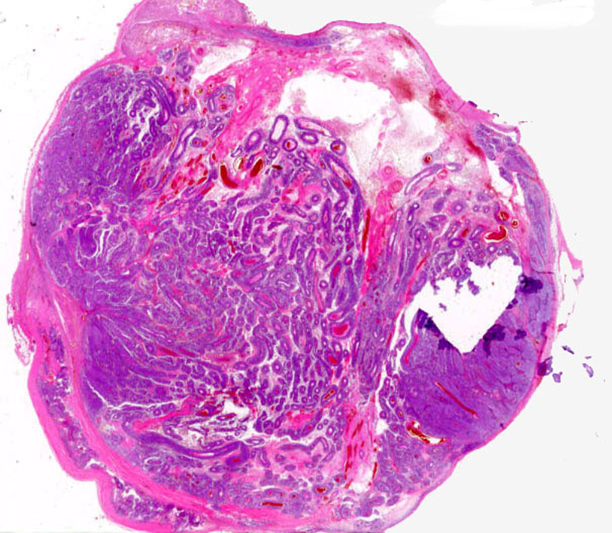 La comunidad de Rantes22: Dos nuevos fármacos mejoran el tratamiento ...