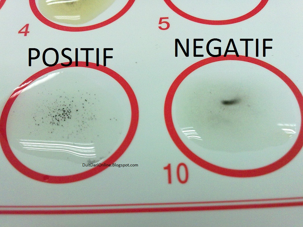 DuitDariOnline - Internet yang sungguh SUPERB!: Ujian RPR @ VDRL ...