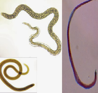 Cacing Trichinella Spiralis | Sehat Online