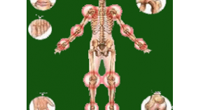 Pengertian Sendi dan Macam macam Sendi