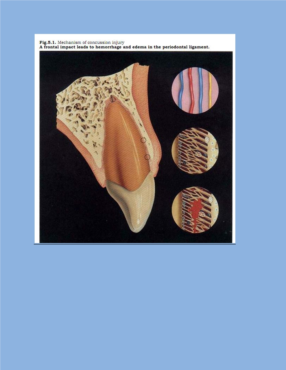 DOs and DONTs in DENTISTRY: CONCUSSION ,SUBLUXATION,EXTRUSION ,LATERAL ...