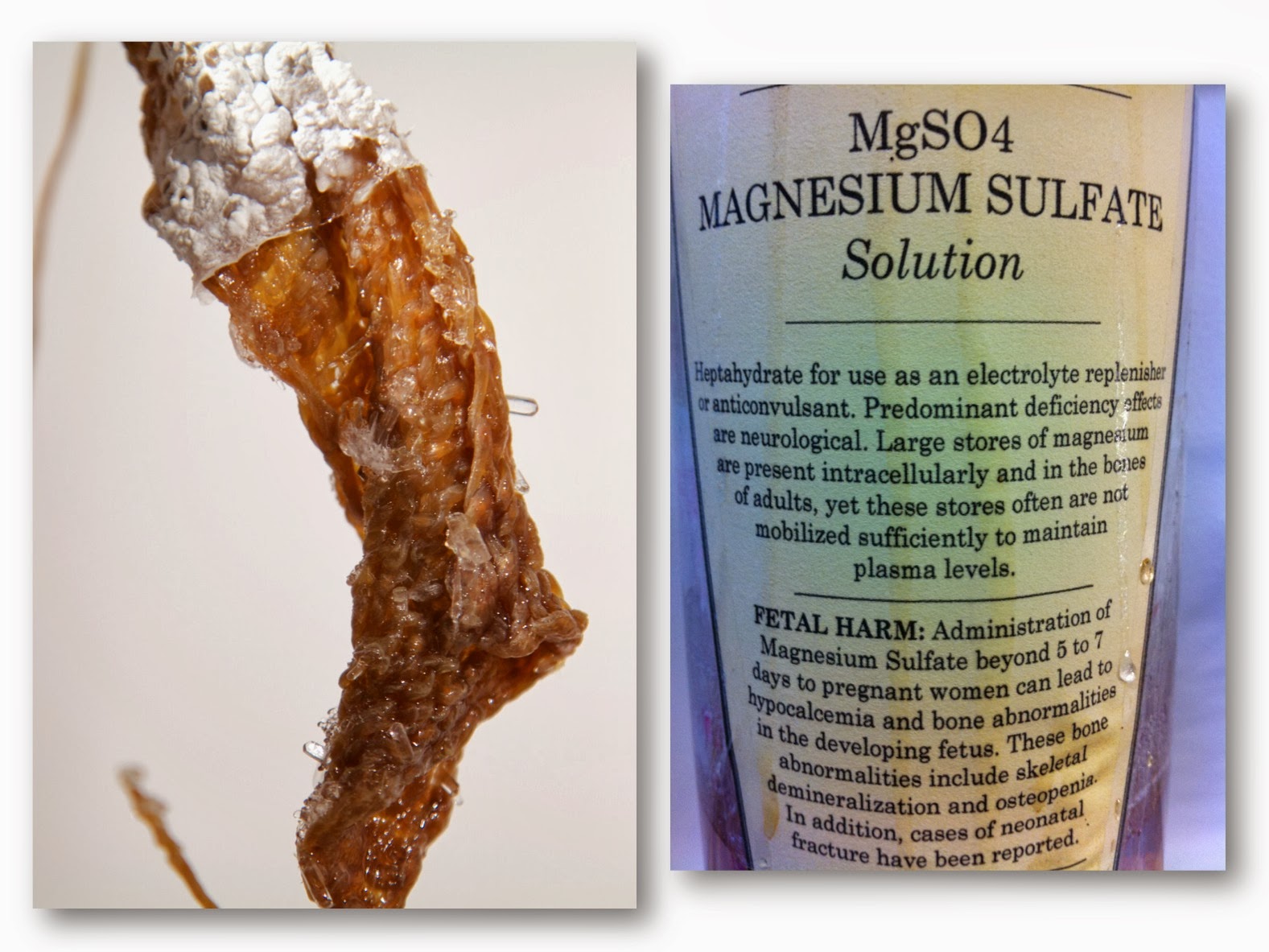 THE OSSIFICATORIUM: Artist Research-Creation Notes by WhiteFeather