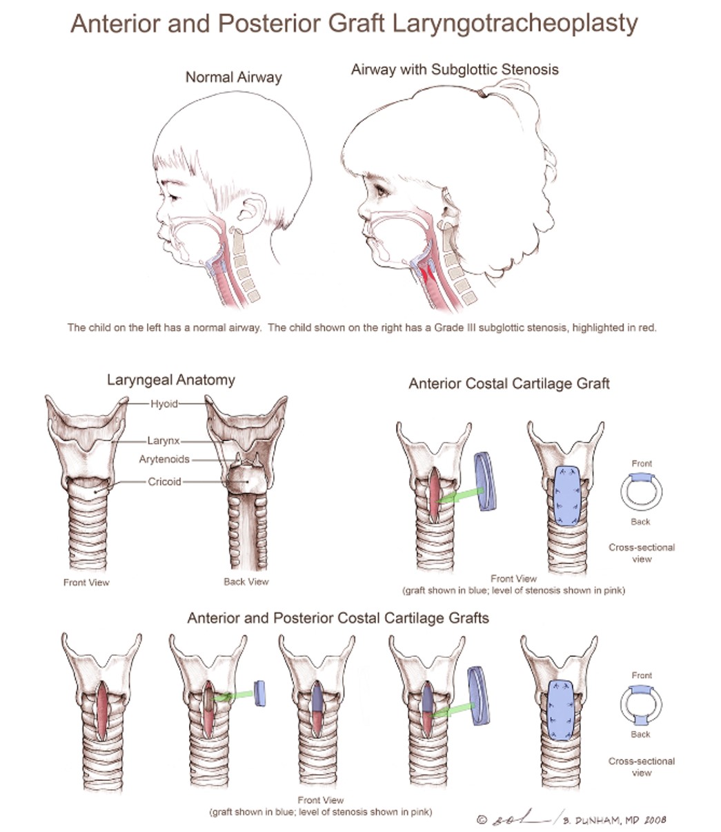Adventures with Ellie: The calm before the… surgery