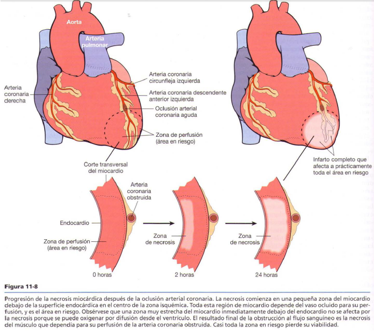 Patología B 2013: CARDIOPATIAS: INSUFICIENCIA CARDIACA CONGESTIVA Y ...