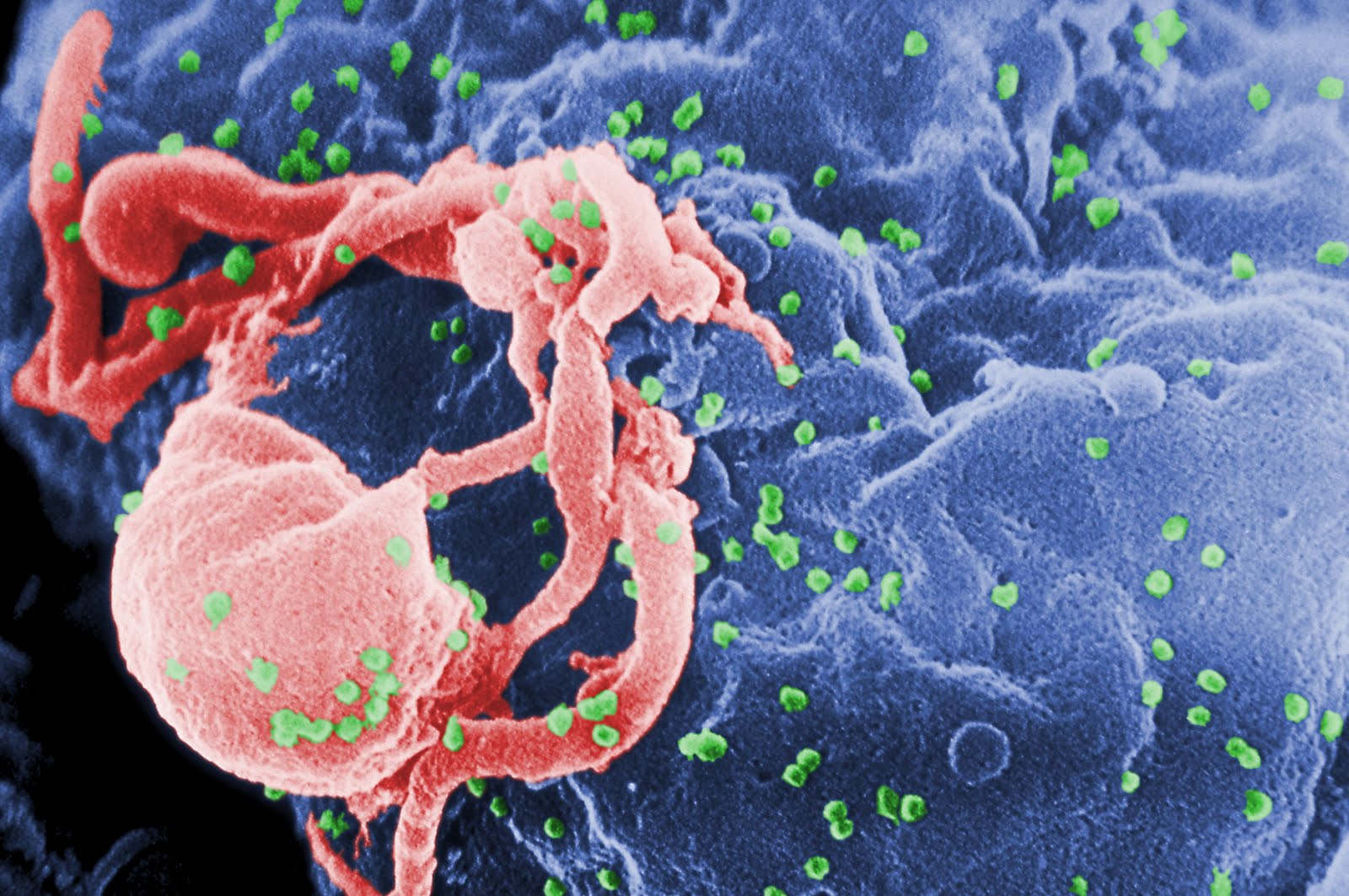 Van Helsing Rede social & Pesquisas: HIV-O vírus da imunodeficiência ...