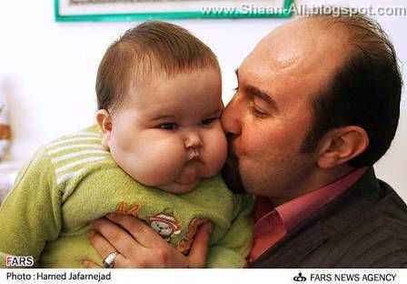 Original Facts: 20 kg baby born in Tehran, Iran Unbelievable Pictures