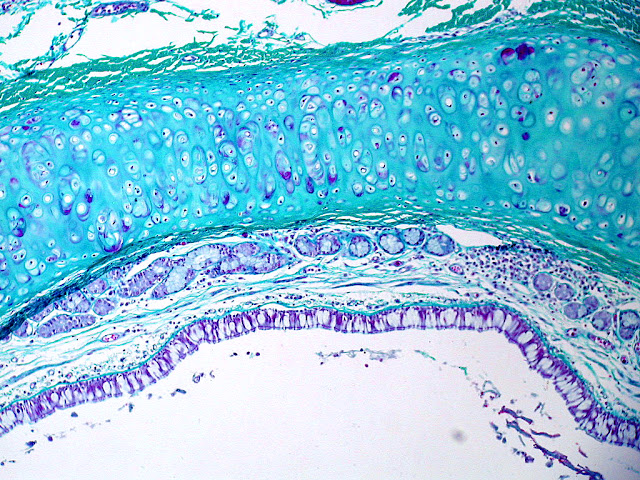 SOS BIOLOGIA CELULAR Y TISULAR: RESPIRATORIO. BRONQUIO