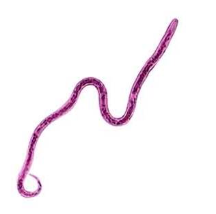 Onchocerca volvulus ~ Examination and Happiness