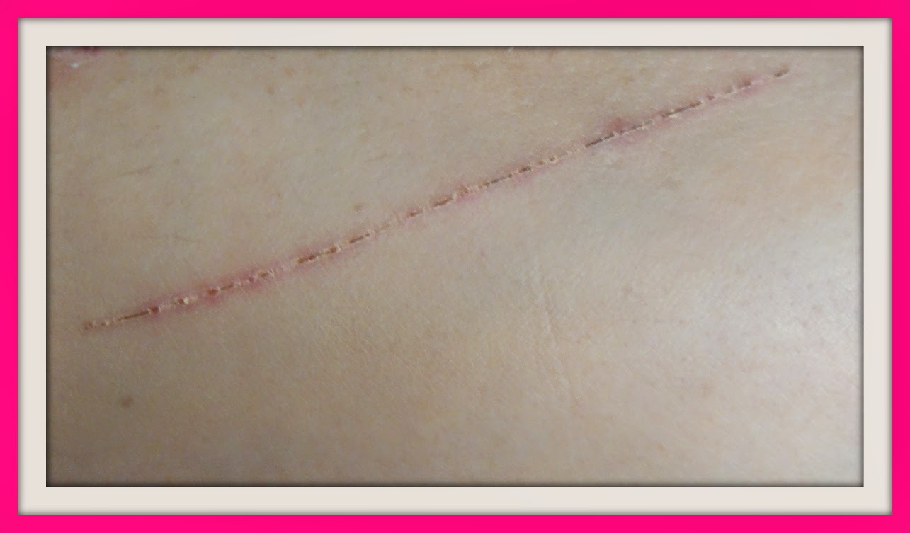 Review: Boo-Boo Cover Up - Heal While you Conceal - Must Be...Pink!