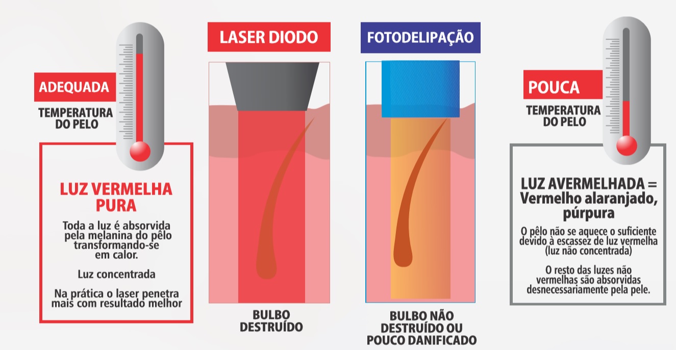 Avaliação Gratuita: Qual é a diferença entre a luz pulsada e o laser?