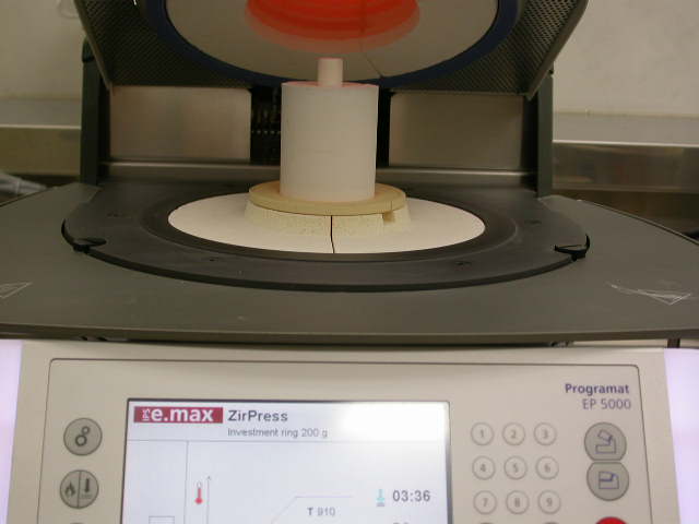 SAYAKA(サヤカ)徒然: e.max ZirPress (ジルプレス) その2