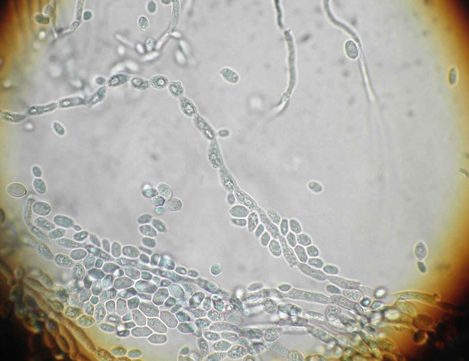 ATLAS MICOLOGIA: EXOPHIALA DERMATITIDIS