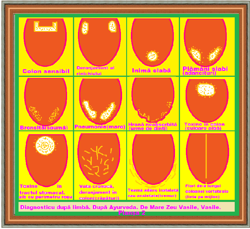 Vasile Ivașca. Yoga Marilor Zeii. Boli și blocaje ale corpului ...