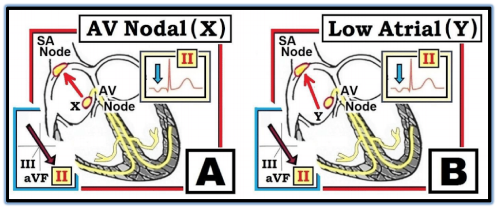 Dr. Smith's ECG Blog: January 2019