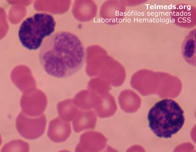 Fichero hematología: Células sanguíneas de la Línea Blanca