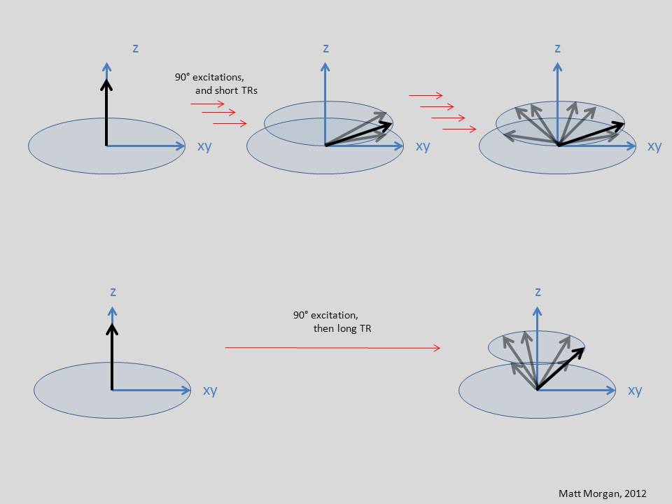 The Pump and the Tubes: Maximum fluid intensity -- bSSFP MRA