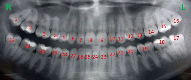 Tooth Identification