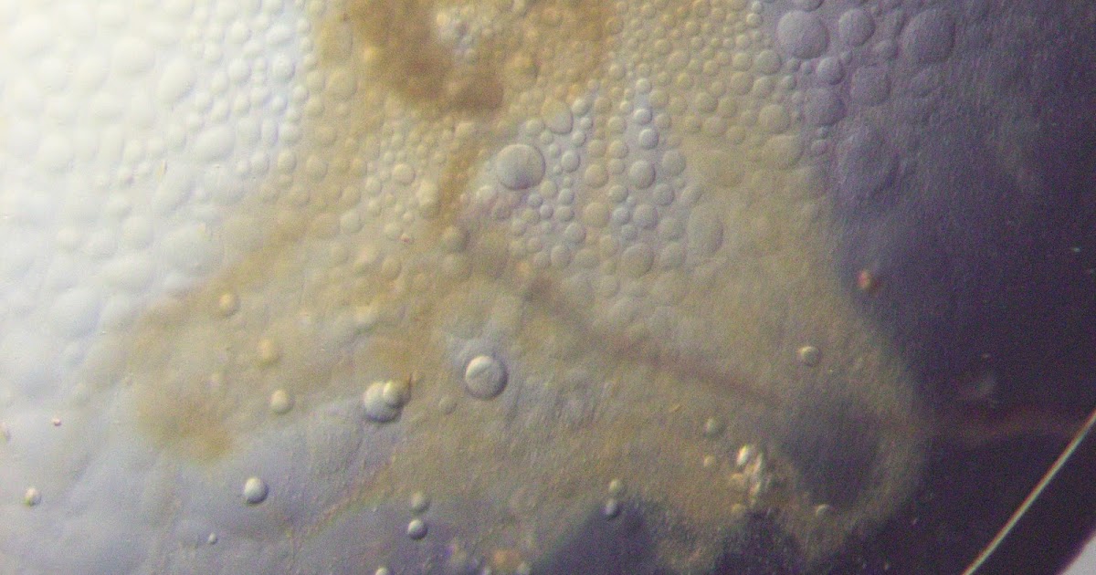 Factor Xa directed Anticlotting serpin like protein (Antithrombin) : MIDAS screen for FXAC MBP ...