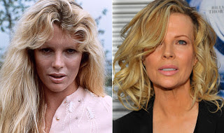 Kim Basinger Plastic Surgery Before and after Facelift and Nose Jobs ...