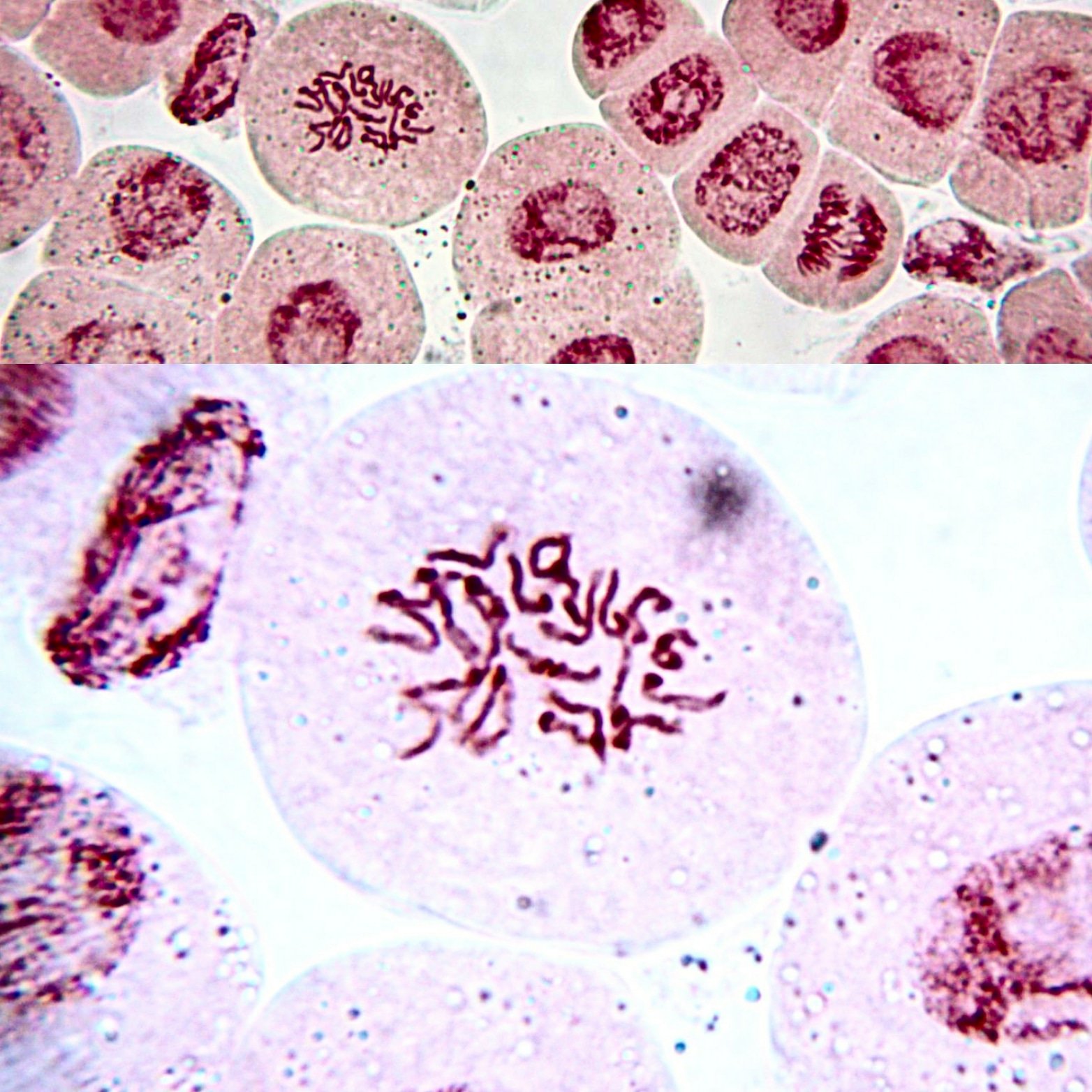 Microscope image of a cell with condensed chromosomes visible.