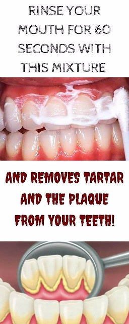 How To Get Rid of Tartar with ONE Simple Ingredient - HEALTH AND DIY IDEAS