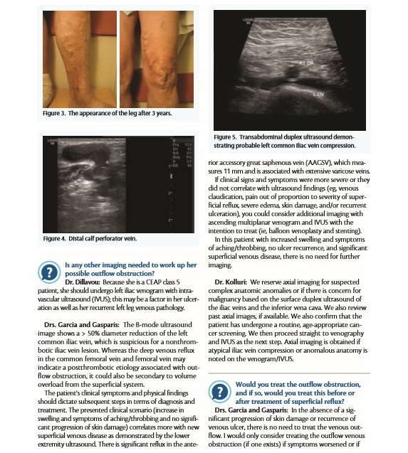 Vascular Mind : CHALLENGING CASES: RECURRENT VENOUS DISEASE FOLLOWING ...