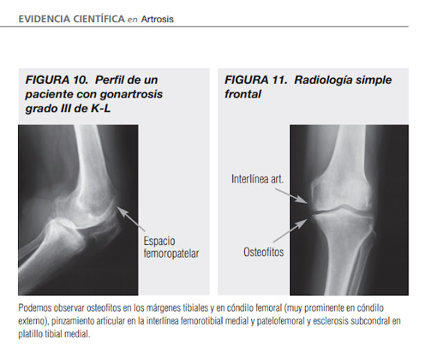 Colegio Mexicano de Ortopedia y Traumatología: Clasificación ...