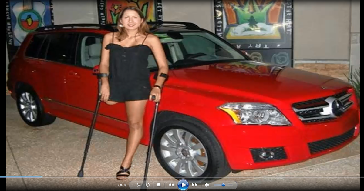 Video Amputee Beautiful Girls I Always Feel That She Is So Princess