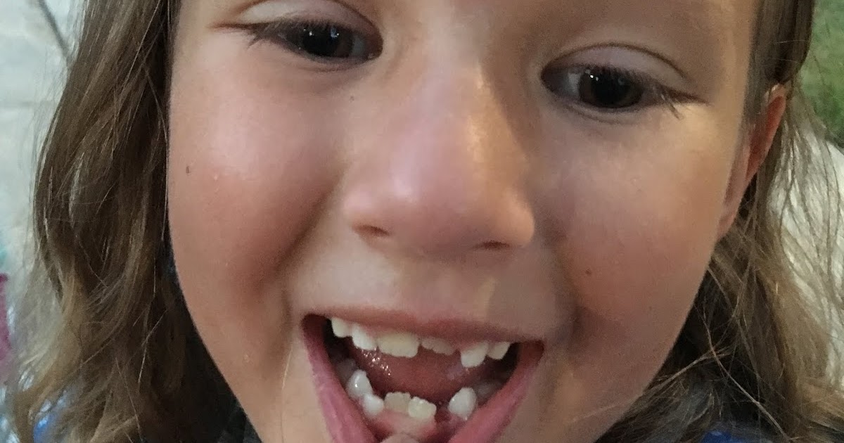 Tutta Nostra Famiglia: Giovanna loses her fifth tooth