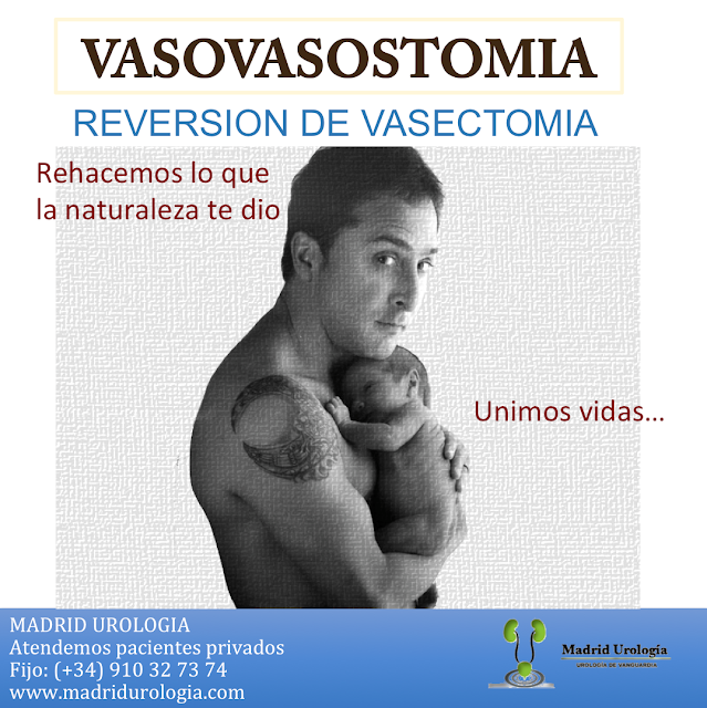 Madrid Urología: Vasovasostomía y Vasoepididimostomía. MU. (Conversión ...