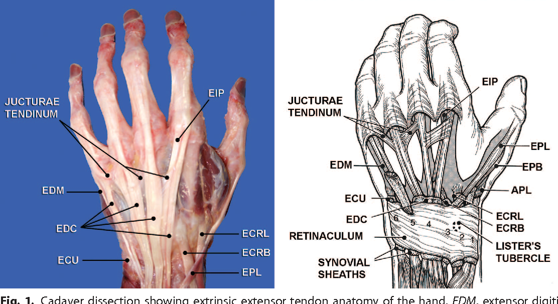 Extensor Tendon Hand
