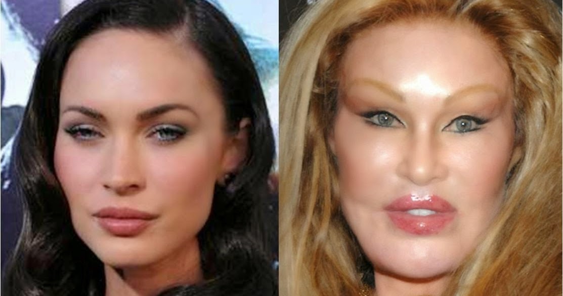 New Fashion Arrivals: US Top 7 Female Celebrities Plastic Surgery Disasters