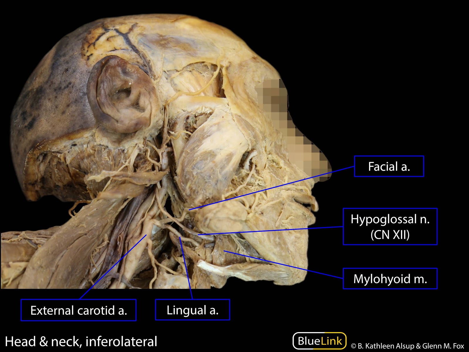 Hyoglossus Cadaver