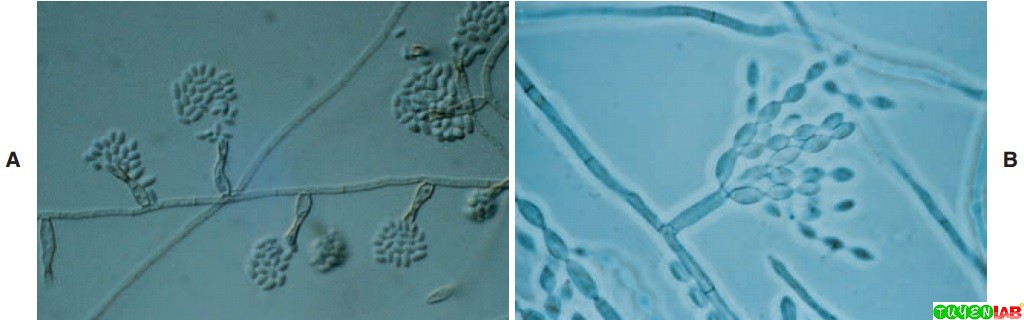 [Parasitology] Atlas of Medically Significant Fungi | Free Medical Atlas