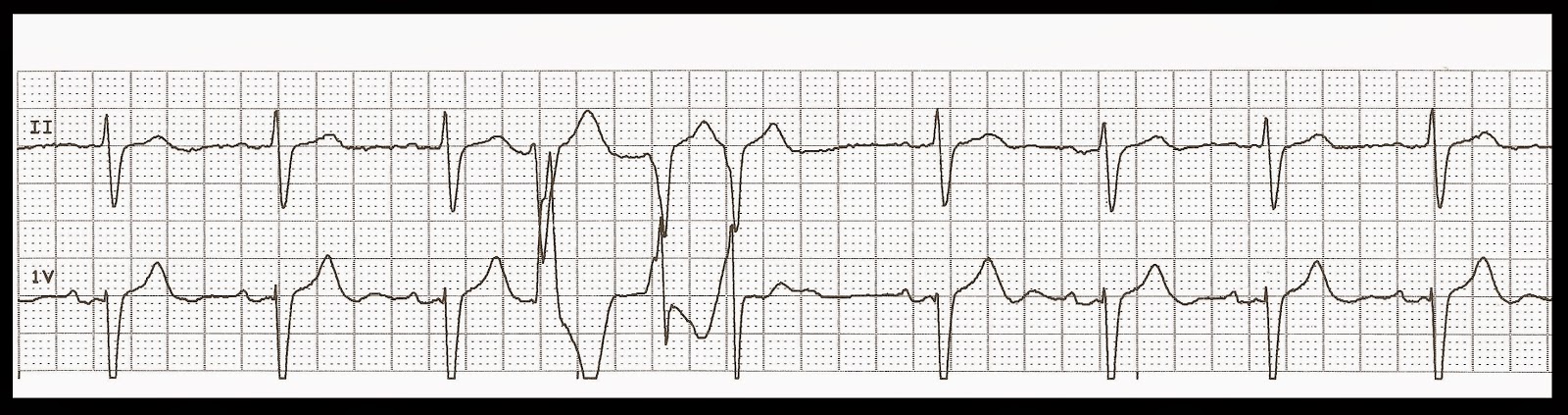 Practice EKG Strips 385