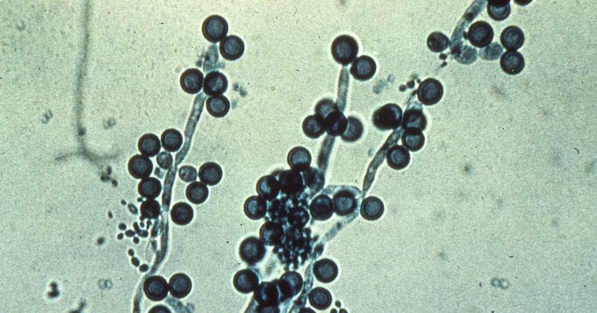 Candidiasis - Tratamiento ~ MEDICINA CLÍNICA Y QUIRÚRGICA