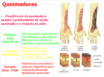 Bombeiroswaldo: QUEIMADURAS 1 2 3 graus