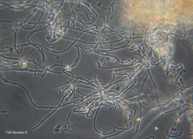 Természeti értékek lencsevégen: A szennyezett vizek lakói