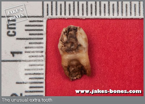 Can you spot what is unusual about this ? : Jake's Bones