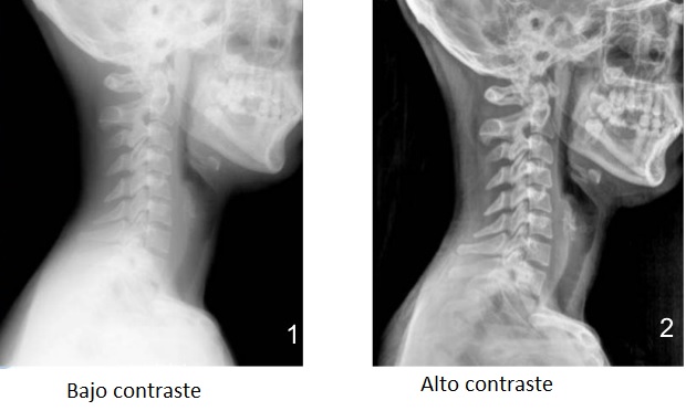 IMAGEN PARA EL DIAGNÓSTICO Y MEDICINA NUCLEAR. Uribarri-Salamanca- 2019 ...