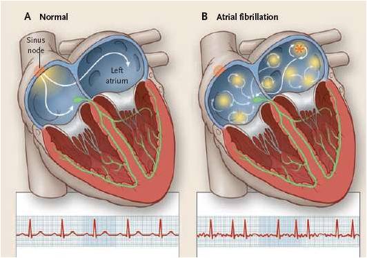 CARDIOLOGIA