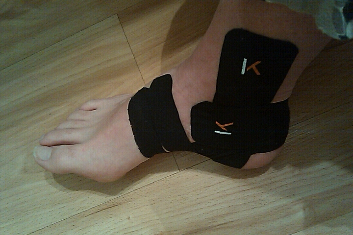 Chris' peroneal tendon surgery: How It All Started