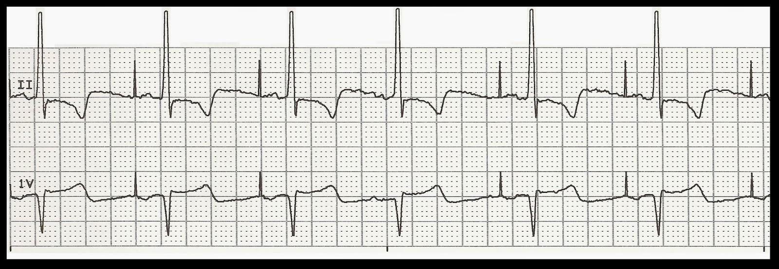 Practice EKG Rhythm Strips 224