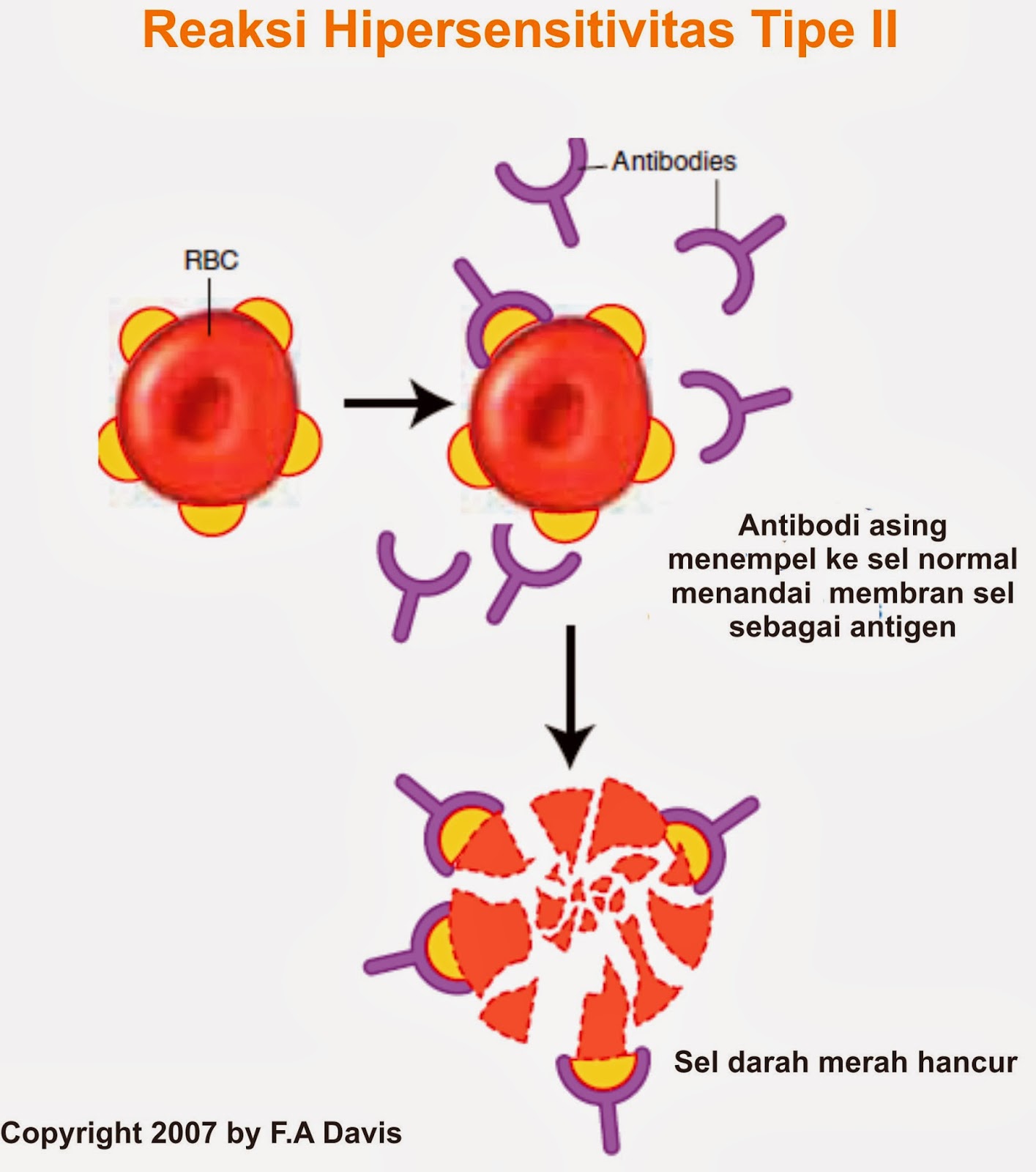 Reaksi Alergi (Hypersensitivity Reaction)